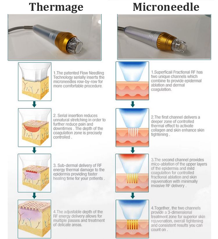 High Tech Fractional Rf Microneedle Skin Tightening Treatment Thermage ...