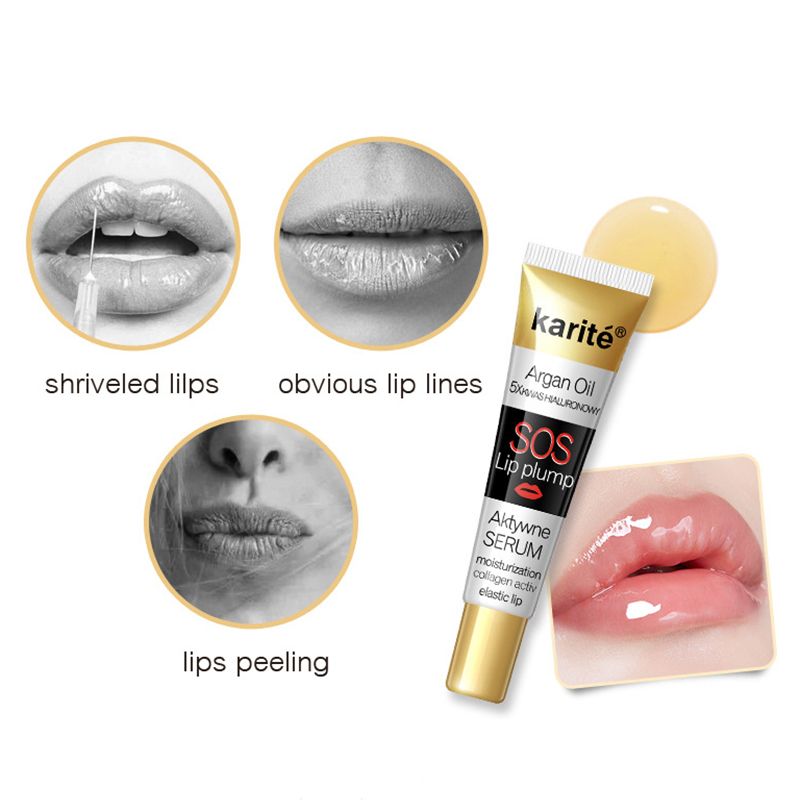 How To Tell If You Have Big Lips