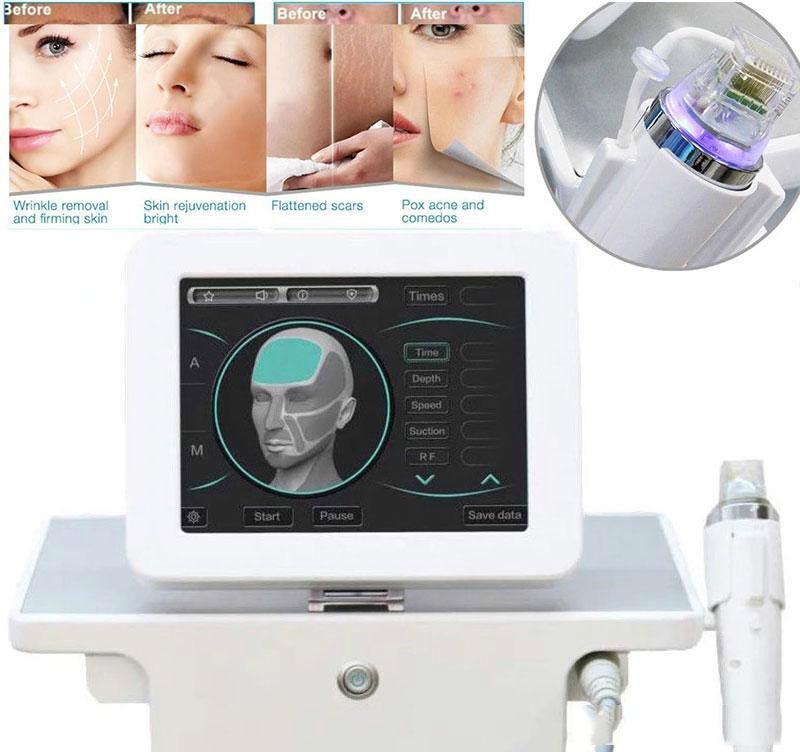 Fractional RF Microneedle Face Care Gold Micro Needle Skin Rollar Acne ...