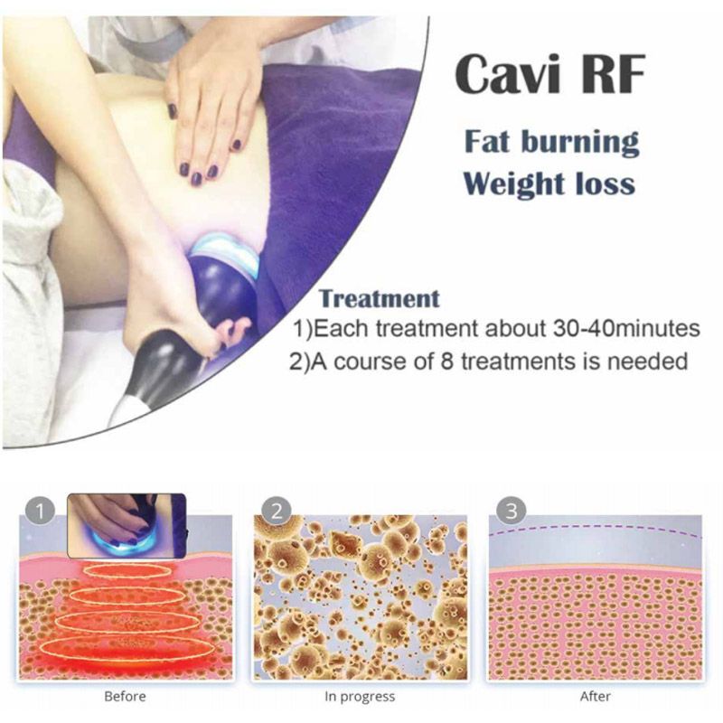 Top Quality Ultrasound Cavitation Slimming Machine Cavi Lipo Ultrasonic ...
