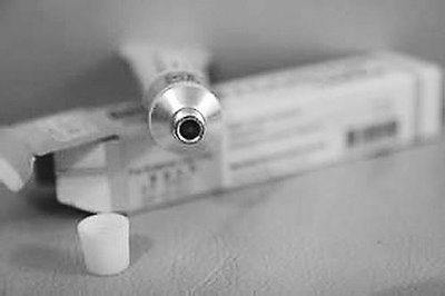 Everything You Need to Know about Hemorrhoid Skin Tag Picture