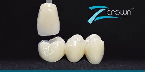 Crown Zirconia The Ultimate Guide
