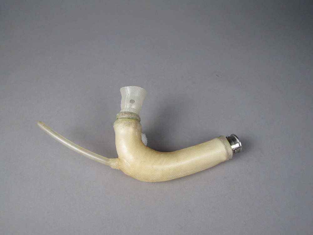 Everything You Need to Know About the Impella Heart Pump