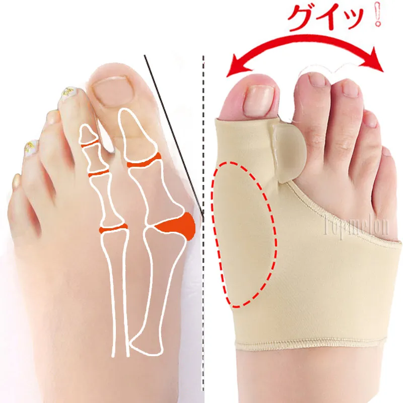 Hallux Valgus Orthèse Big Tee Support Doublures Bunion Silicone ...
