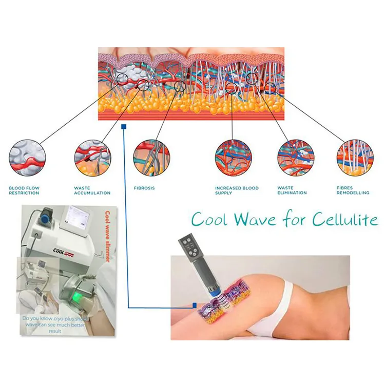 Home Use Beauty Machine For Cellulite Reduction With Cool Cryotherapy ...