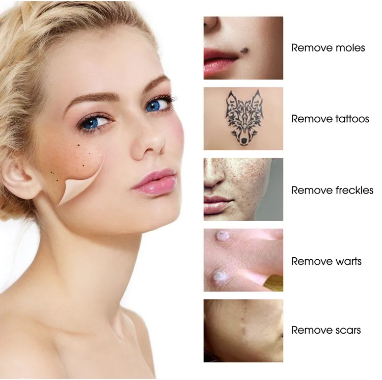 Skin Mole Tattoos