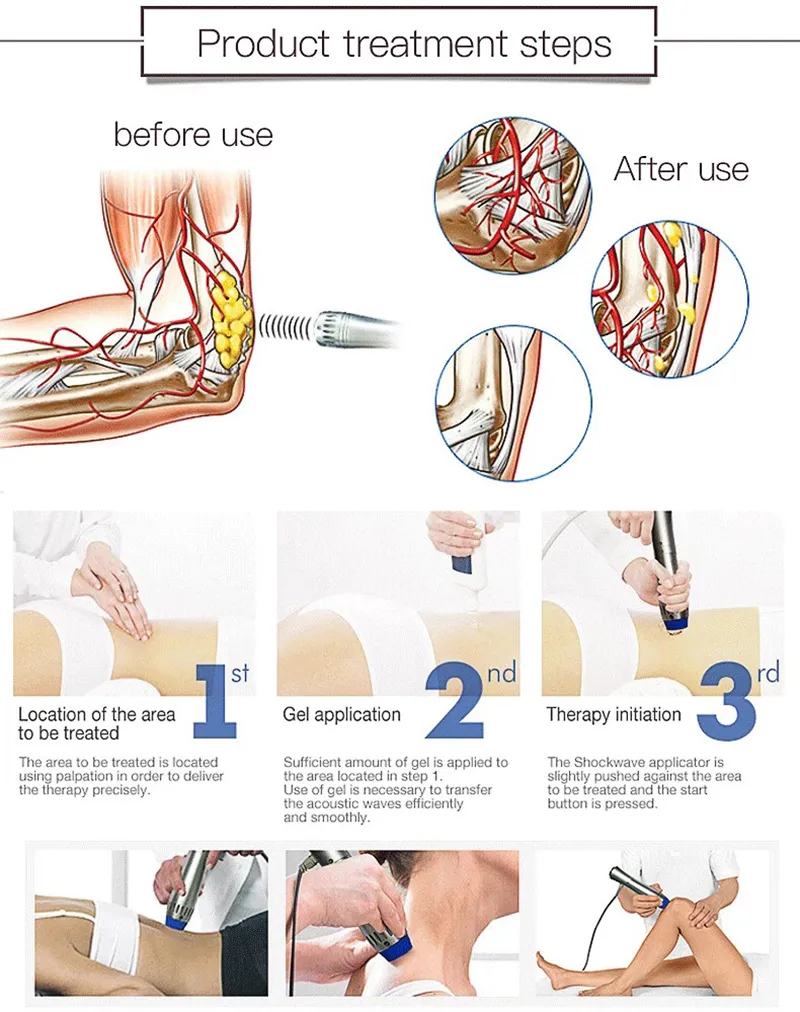 Advanced Shockwave Physiotherapy System With ED Treatments And ...