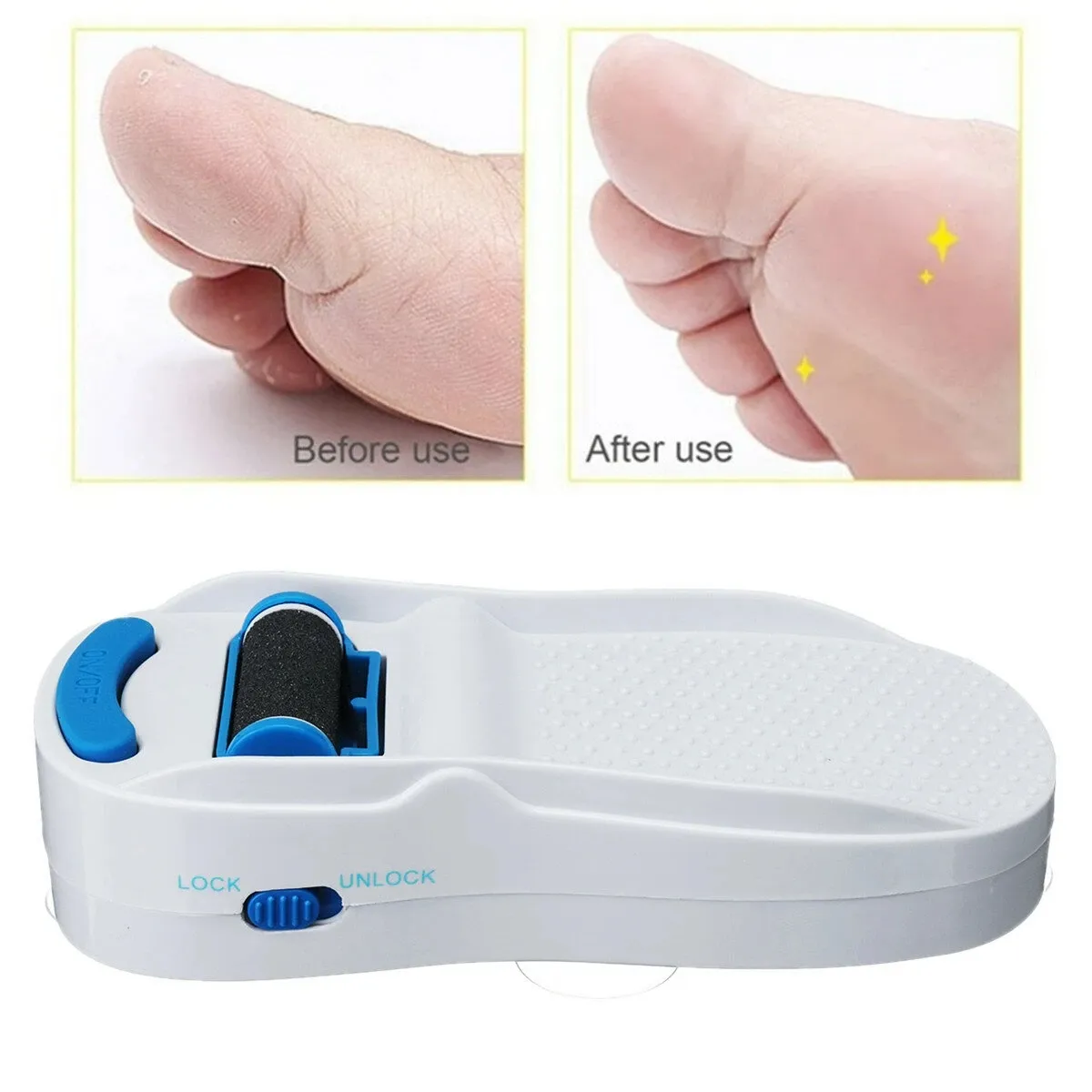 Electric Foot Callus Remover: Waterproof Foot Skin Scraper for Smooth ...