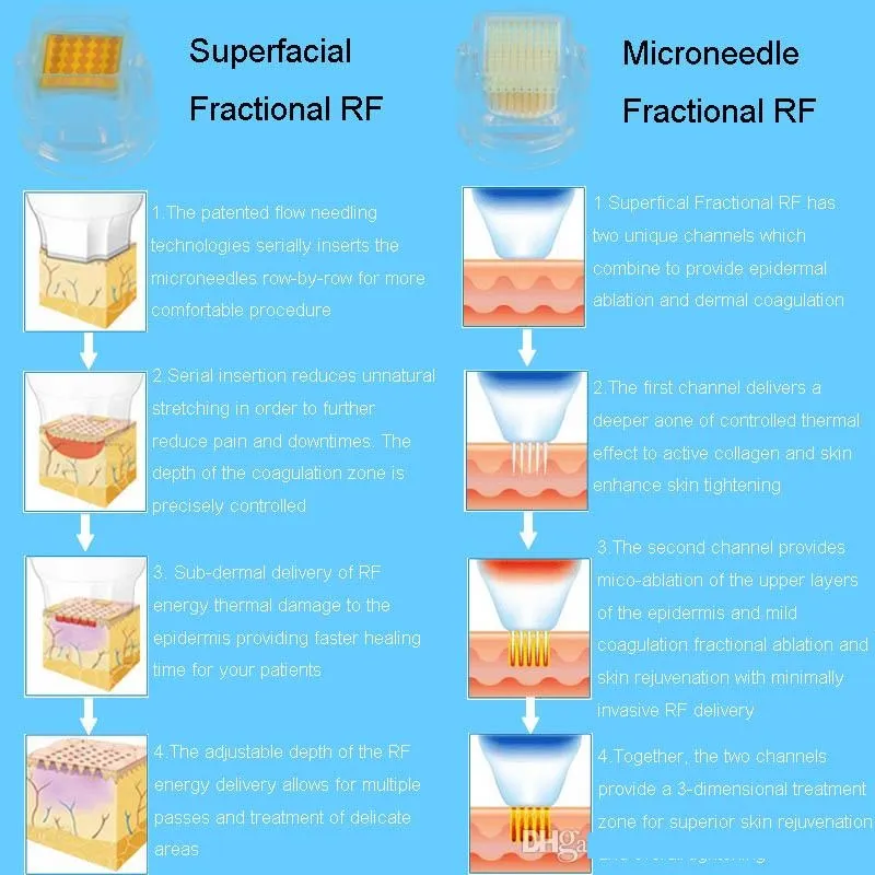 Advanced RF Facial And Body Shaping Therapy For Bipolar And Fractional ...