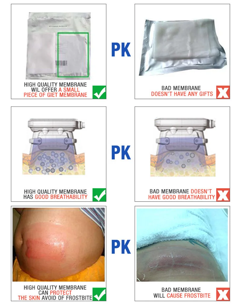 Fat Freezing Gel Sublimation Patches For Cryolipolysis Machine Anti ...