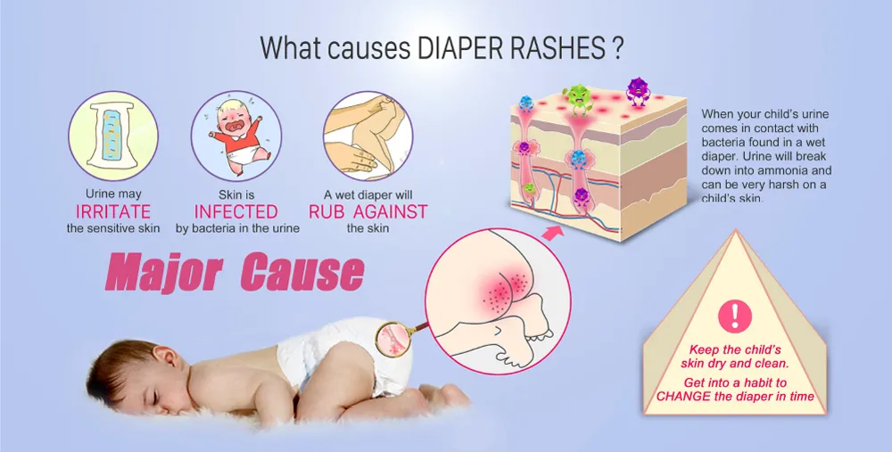 Home Smart Peeing Buckle Baby Elderly Diapers... From ...