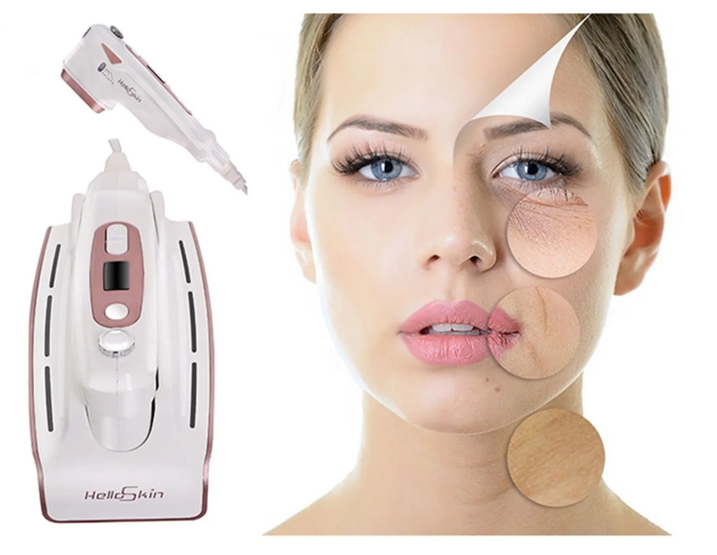 HelloSkin HIFU Machine High Intensity Focused Ultrasound For Face ...
