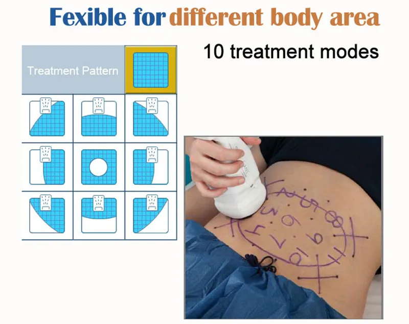 Liposonix Slimming Machine High Intensity Focused Ultrasound Fat ...