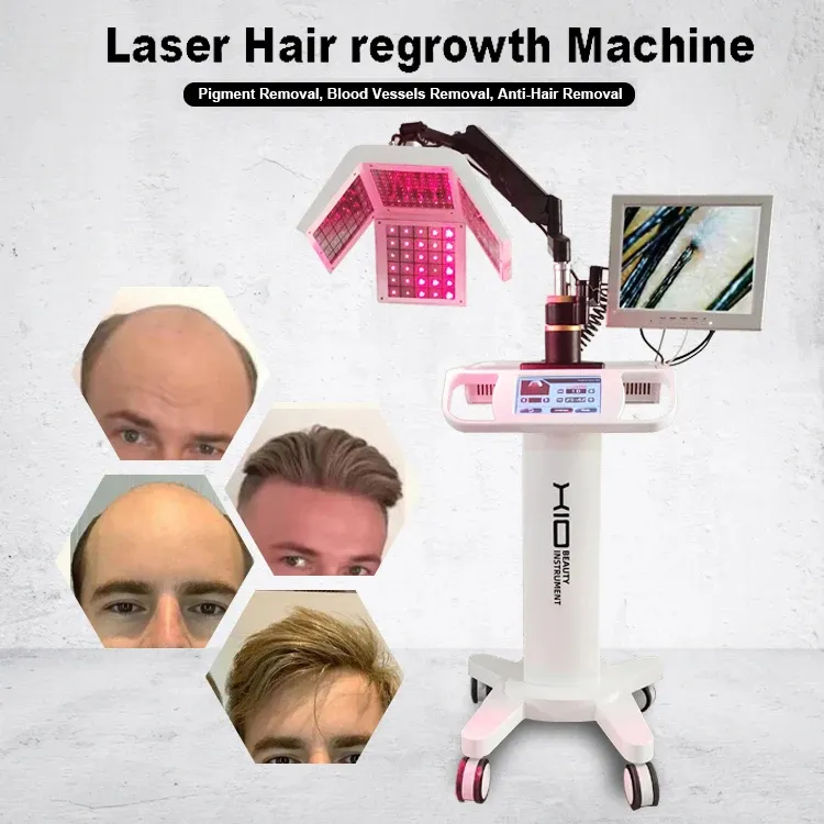 650nm Diode Hair Growth System: 5 In 1 Hair Restoration Device With ...