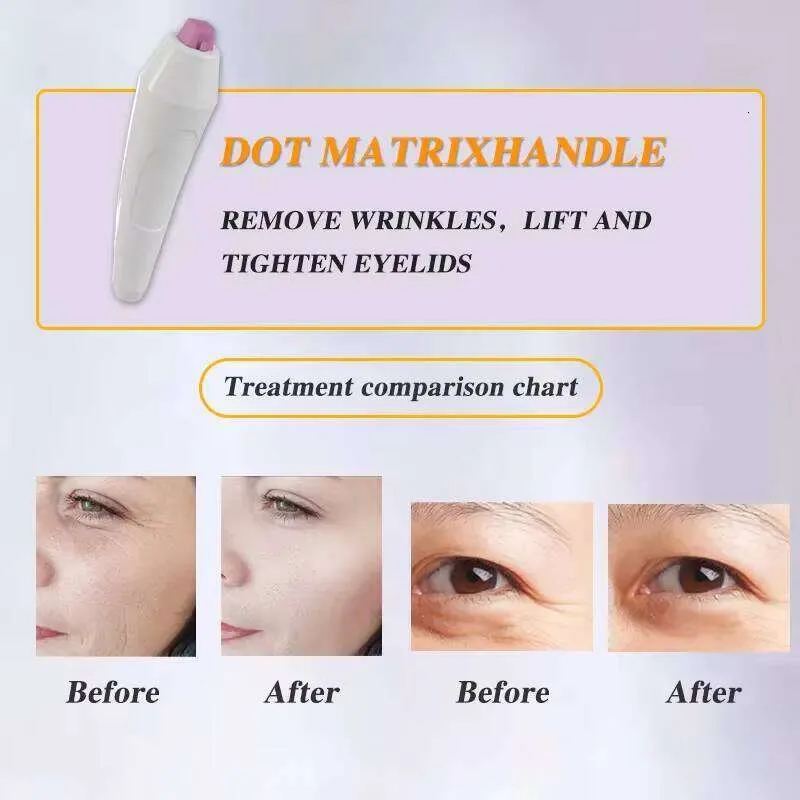 Professional Fractional Plasma Thermal Skin Tightening For Dark Spot ...