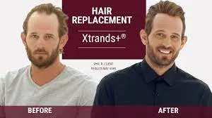 A Comprehensive Guide to Finding the Best Hair Restoration Services