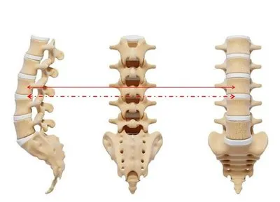 How to Relieve Back Pain Caused by Intervertebral Disc Problems