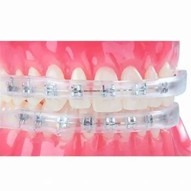 Comfort Covers for Braces How to Choose the Best Ones?